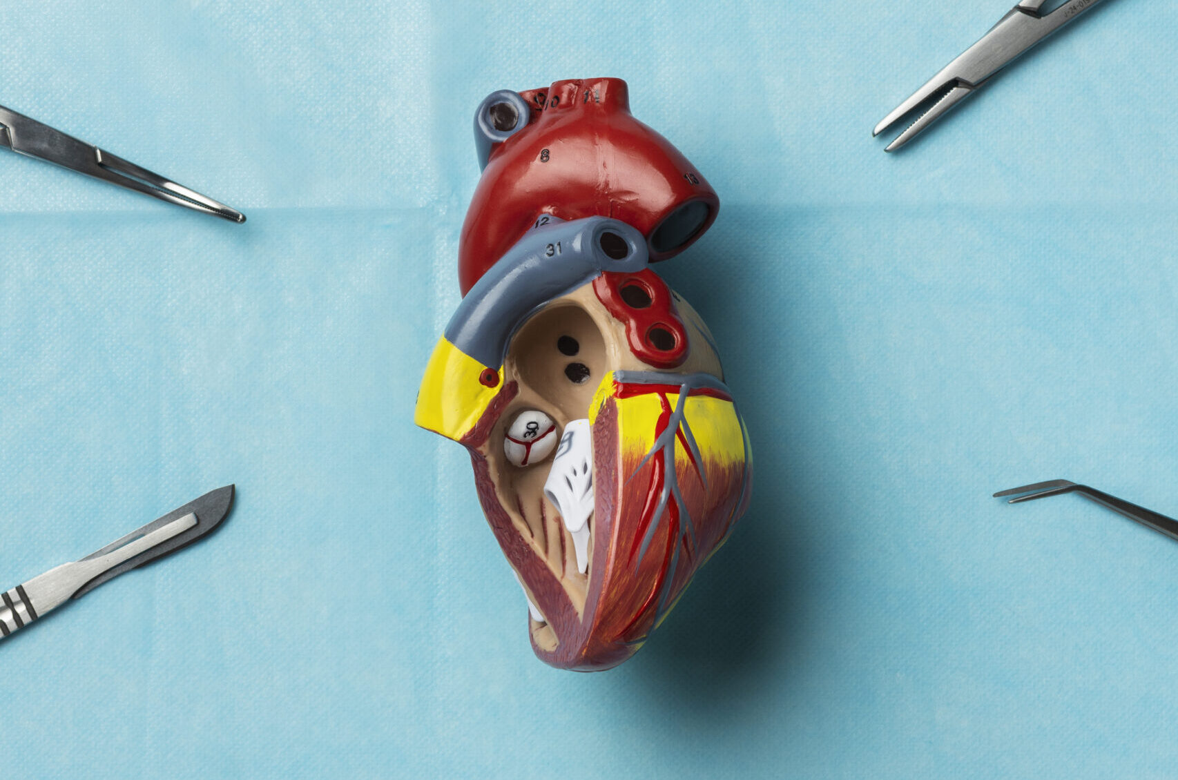 Secondary Case Study 6: Best practice management for apical HCM: case ...